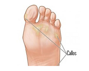 Centro de Pie y Tobillo de Guatemala - Doctor. Herman Hidalgo